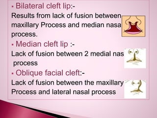 Teratogens And Cleft Types | PPTX