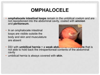 Teratologi sistem digestive dr.Adhita Dwi Aryanti.,M.Kes