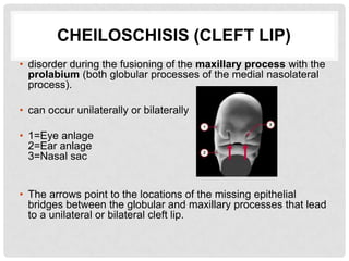 Teratologi sistem digestive dr.Adhita Dwi Aryanti.,M.Kes