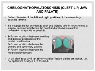 Teratologi sistem digestive dr.Adhita Dwi Aryanti.,M.Kes