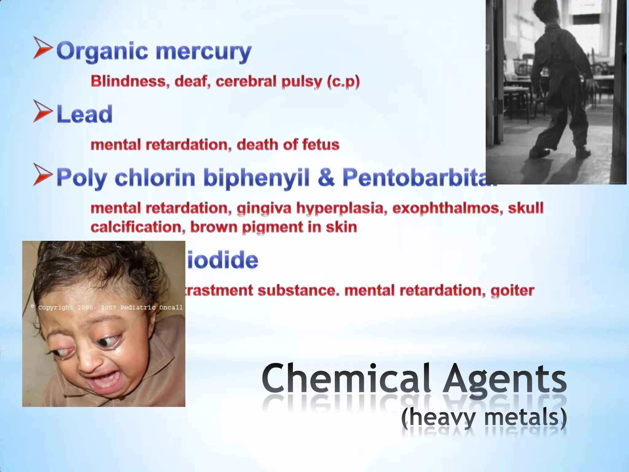 Teratology teratogenesis-birth defect-congenital malformation- anomaly ...