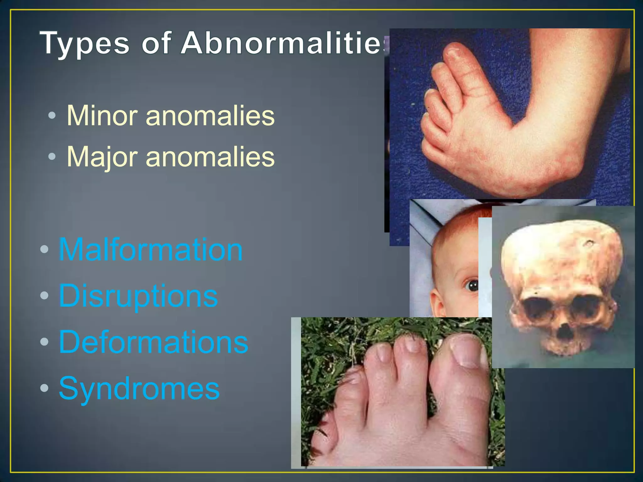 Teratology teratogenesis-birth defect-congenital malformation- anomaly ...