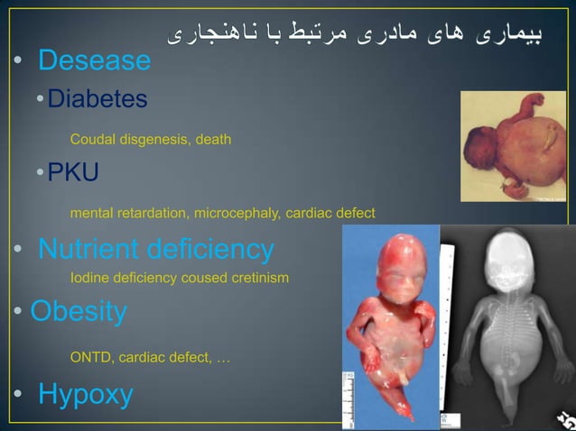 Teratology teratogenesis-birth defect-congenital malformation- anomaly ...
