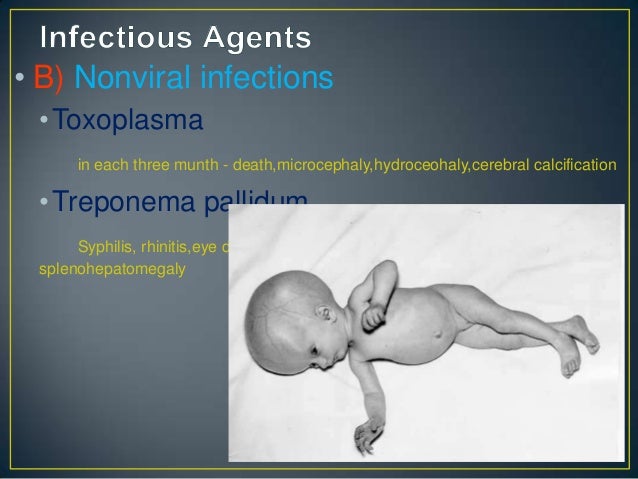 Teratology teratogenesis-birth defect-congenital malformation- anomal…