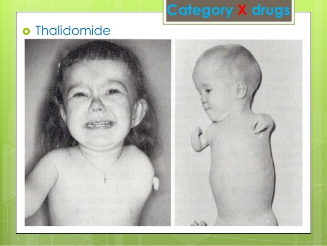 Teratology teratogenesis-birth defect-congenital malformation- anomal…