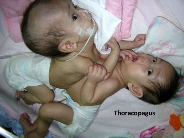 Teratology & embryology