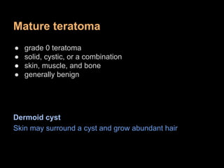 Teratoma | PDF