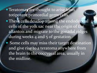 Teratoma in children | PPTX