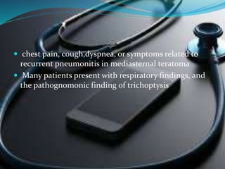 Teratoma in children | PPTX