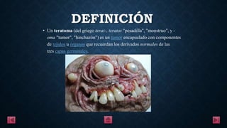 TERATOMAS MEDICINA VETERINARIA | PPTX