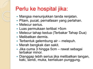 Rawatan Terbakar kimia | PPTX