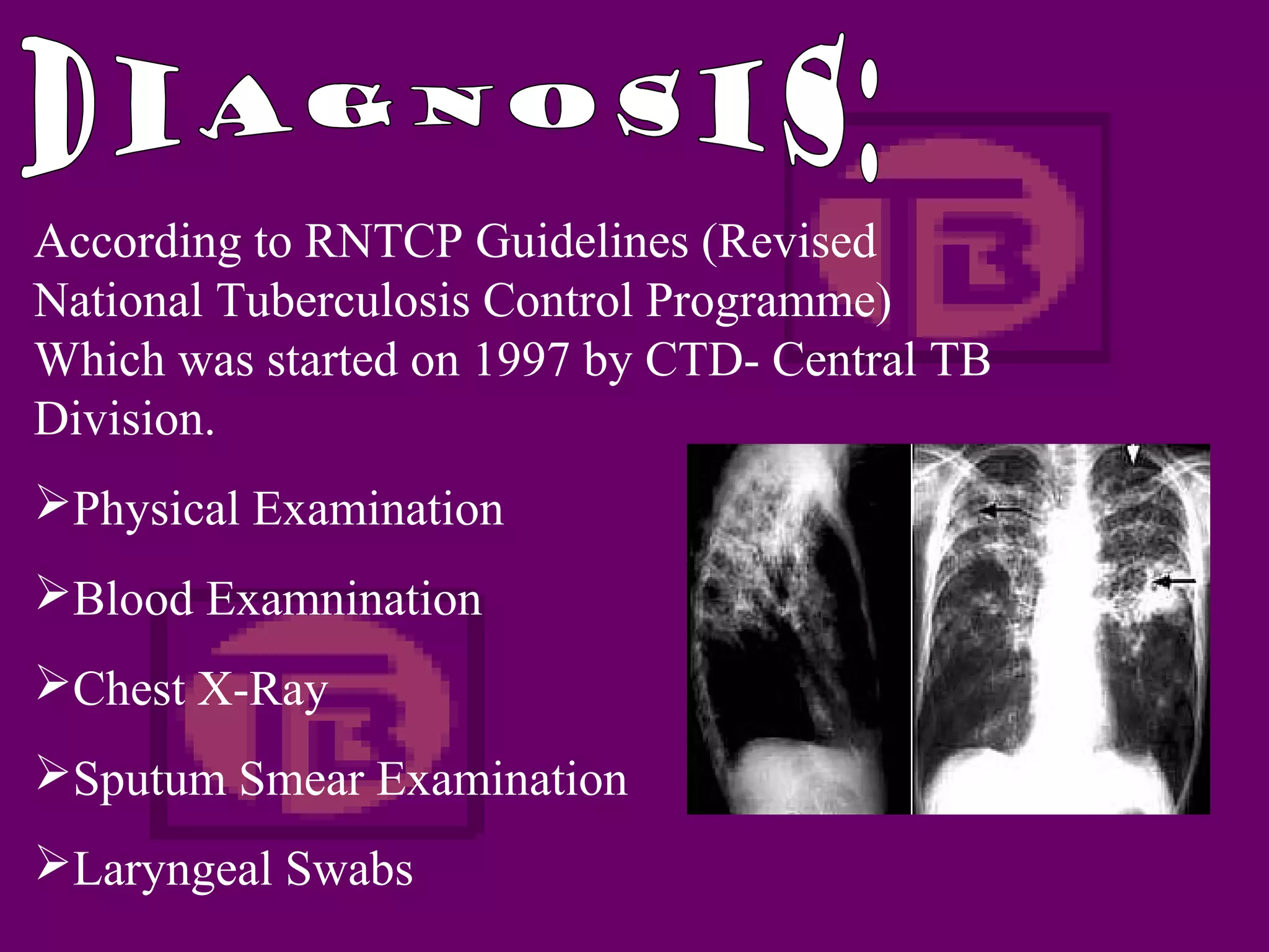 Turberculosis by Dr. Ankit | PPT