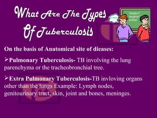 Turberculosis by Dr. Ankit | PPT