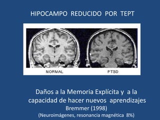 Tercera Unidad Neurobiologia-endocri del TEPT (2) (1).pptx