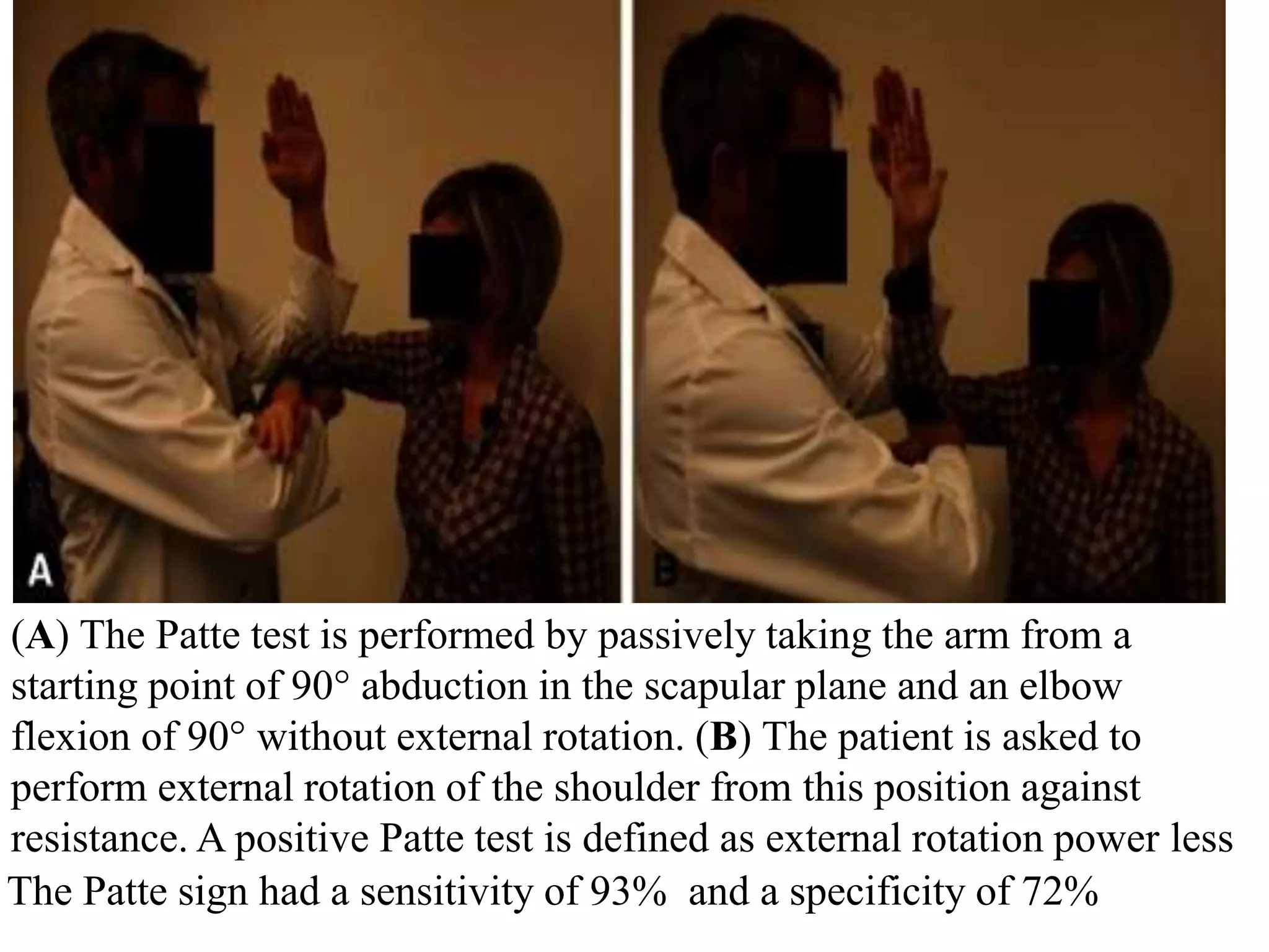 Teres minor tear test | PPT | Free Download
