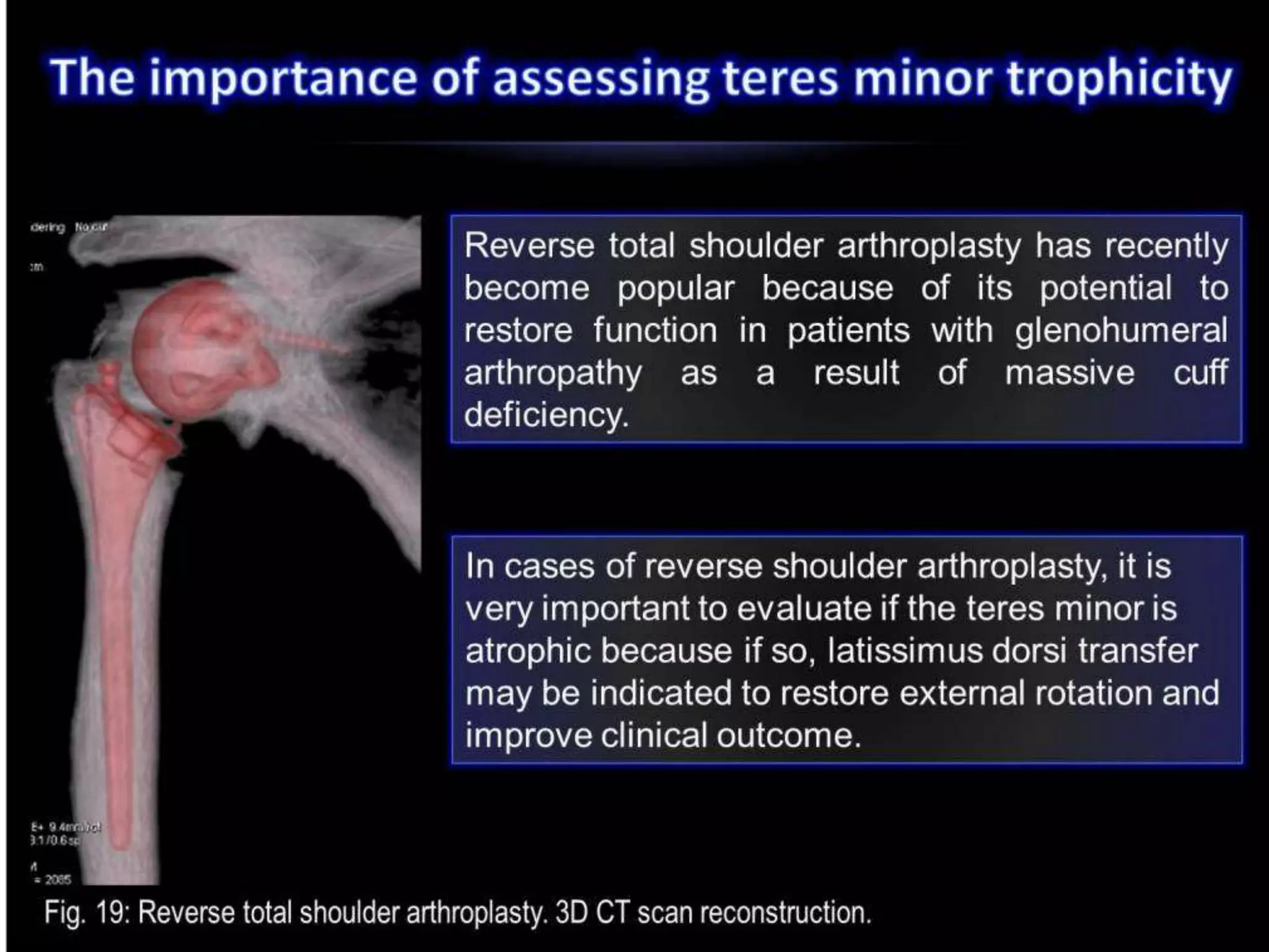 Teres minor tear test | PPT | Free Download