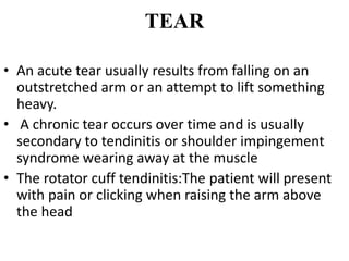 Teres minor tear test | PPT