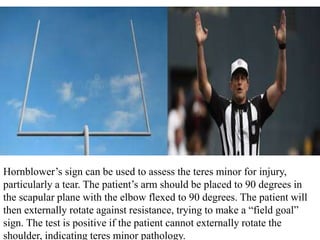 Teres minor tear test | PPT