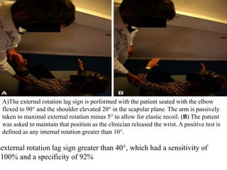Teres minor tear test | PPT