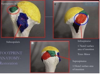 Teres minor tear test | PPT