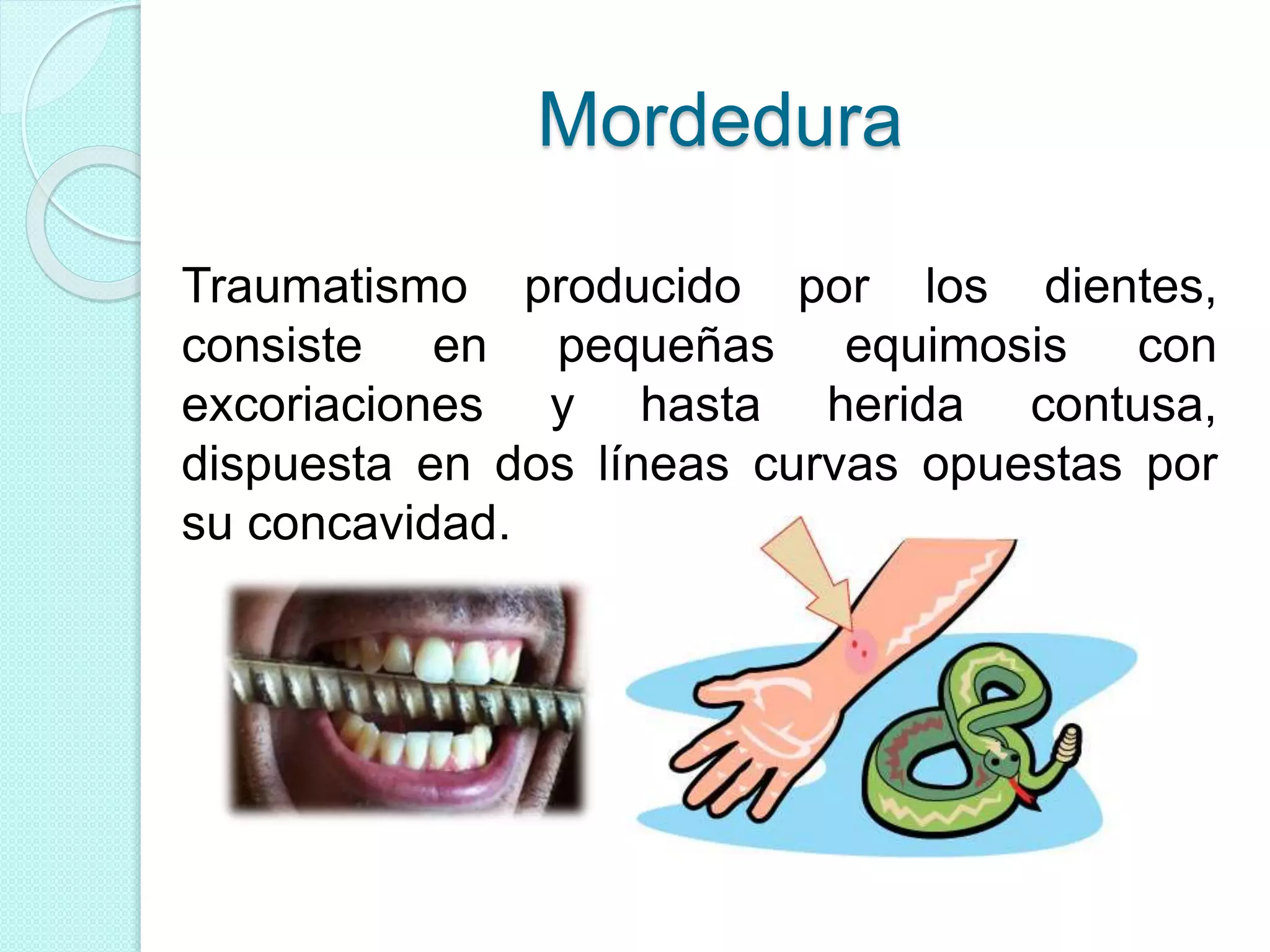 Terma 5 contusiones | PPTX
