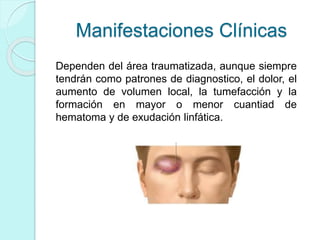 Terma 5 contusiones | PPTX