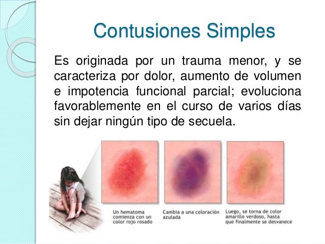 Terma 5 contusiones