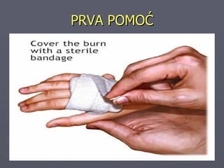 Termicka ostecenja | PPT