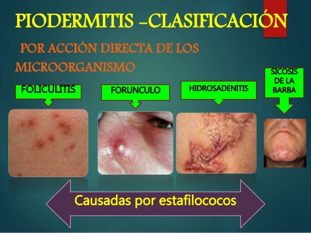 brian arnez ayaviri piodermitis