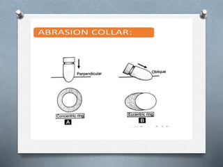 Terminal ballistics | PPTX