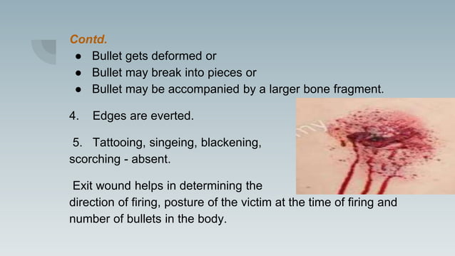 Terminal ballistics | PPTX | First Aid | Injuries
