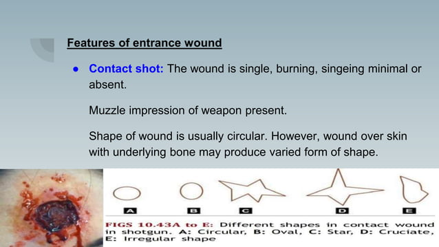 Terminal ballistics | PPTX | First Aid | Injuries