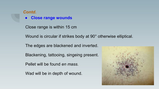 Terminal ballistics | PPTX | First Aid | Injuries