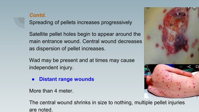 Terminal ballistics | PPTX | First Aid | Injuries
