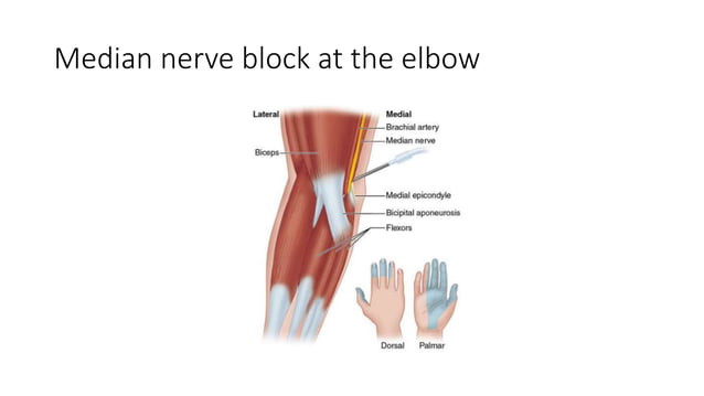 terminal nerve block.pptx