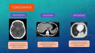 TERMINOLOGÍA EN RADIOGRAFIA, TOMOGRAFIA, RESONANCIA.pdf
