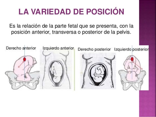 Terminología obstétrica más común