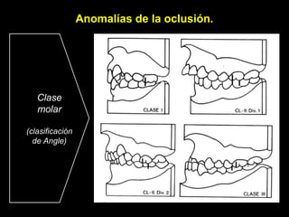 Terminologia ortodontica | PPT