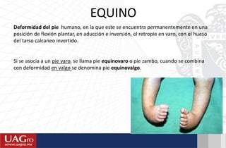Terminología ortopedica | PPTX