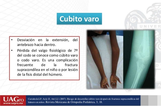 Terminología ortopedica