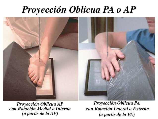 Terminología sobre Posiciones Radiológicas