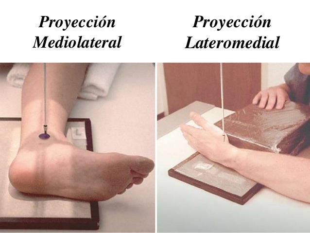 Terminología sobre Posiciones Radiológicas