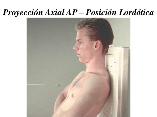 Terminología sobre Posiciones Radiológicas
