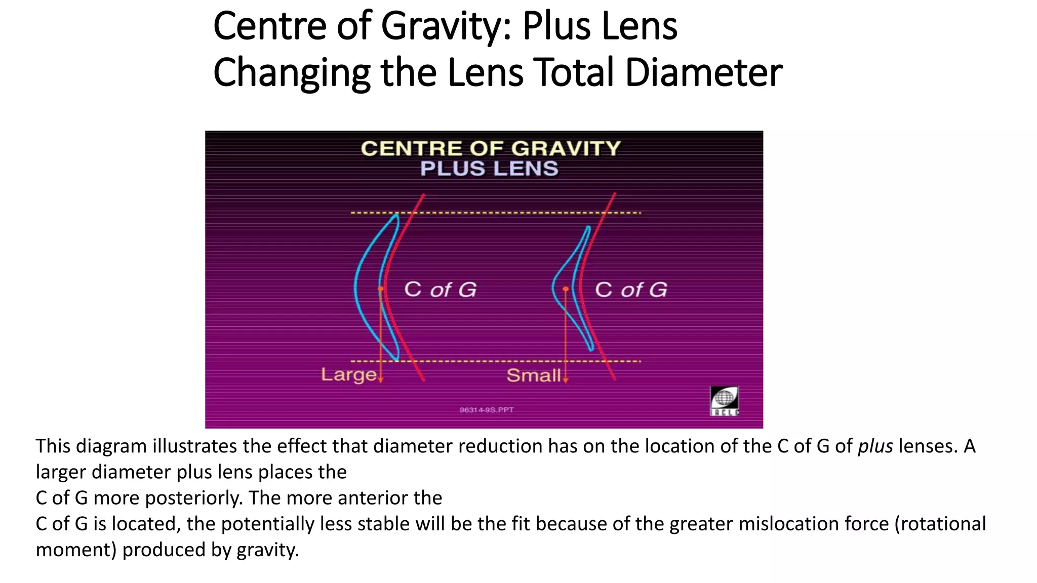 Terminologies in contact lens dimension and manufacturing of RGP lenses ...