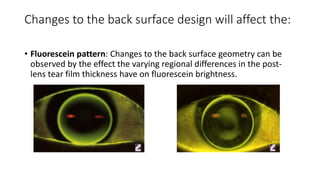 Terminologies in contact lens dimension and manufacturing of RGP lenses ...