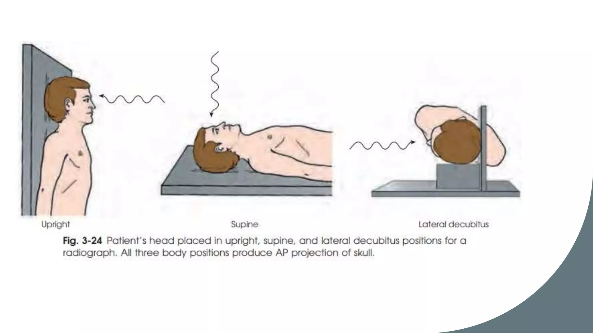 X-ray imaging planes and terminologies | PPTX