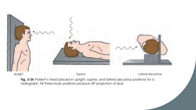 X-ray imaging planes and terminologies | PPTX