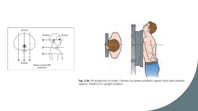 X-ray imaging planes and terminologies | PPTX