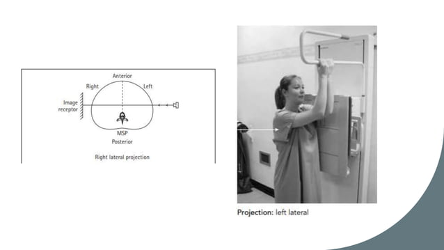 X-ray imaging planes and terminologies | PPTX