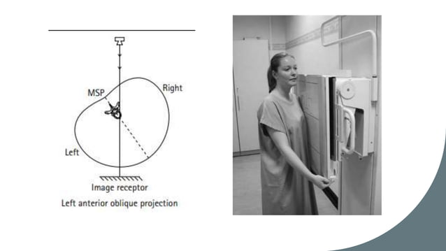 X-ray imaging planes and terminologies | PPTX